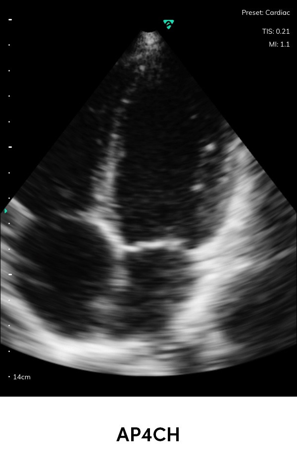 8 Best Portable Echo Ultrasound Machines for Cardiac Care