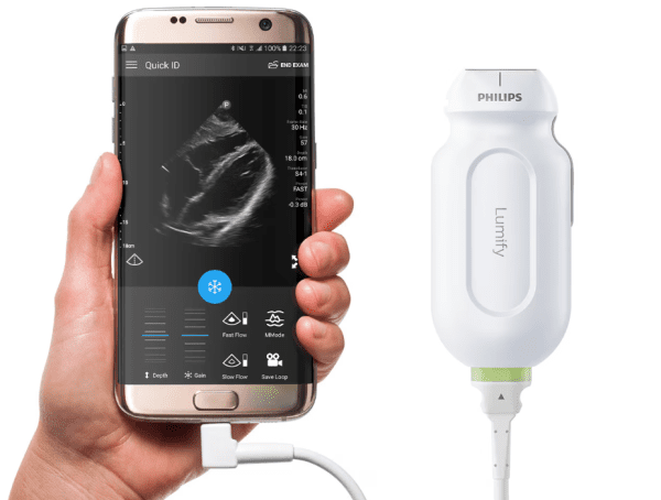8 Best Portable Echo Ultrasound Machines for Cardiac Care