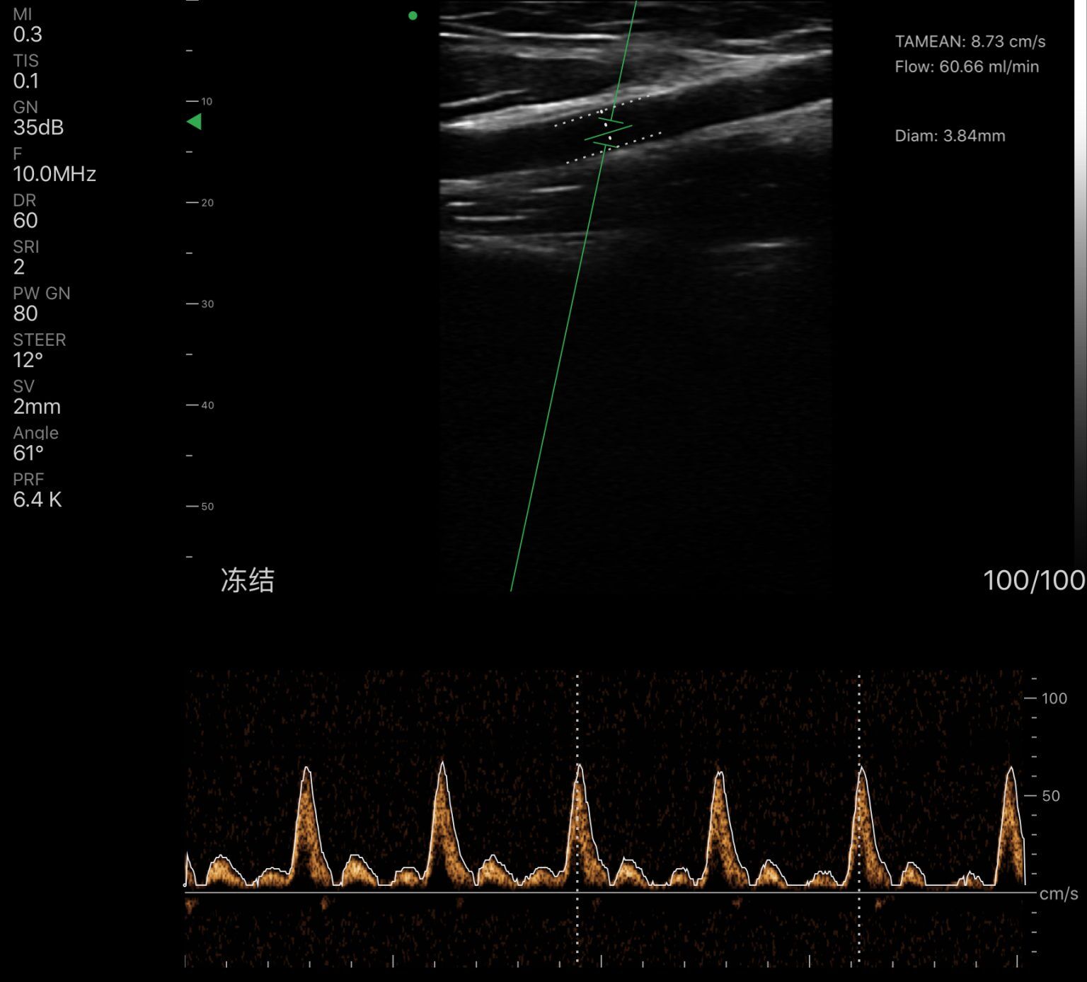 Handheld Ultrasound Guide 2025-2026: Types, Uses & Costs