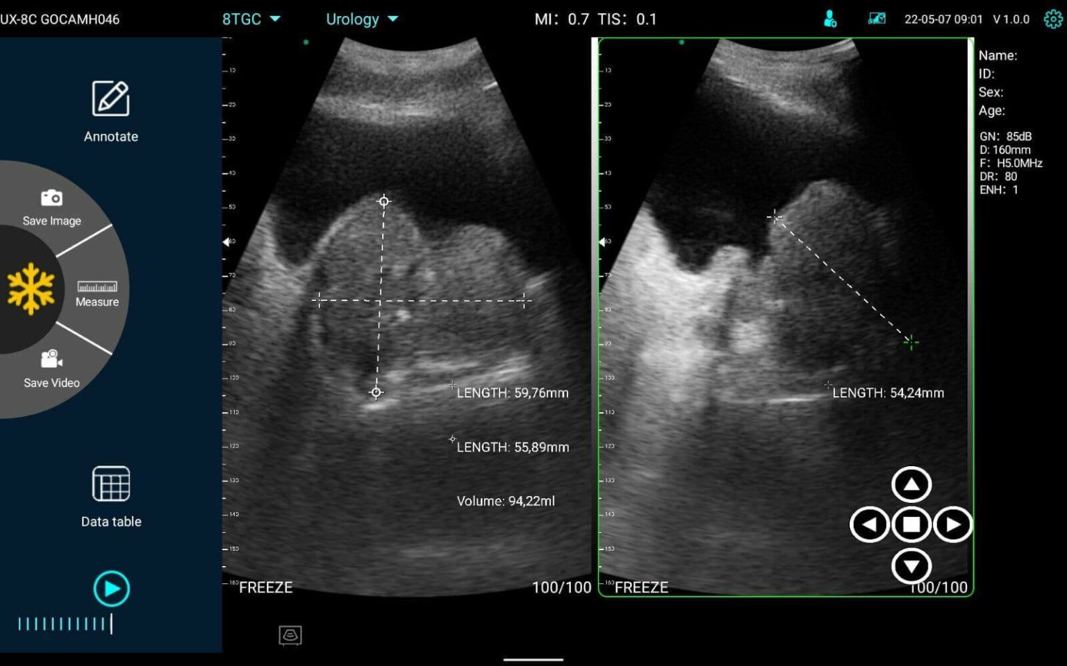 Handheld Ultrasound Guide 2025-2026: Types, Uses & Costs