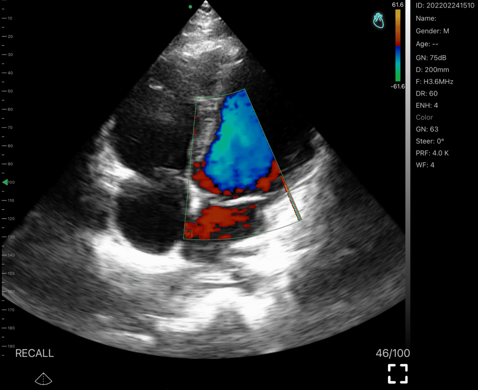 Handheld Ultrasound Guide 2025-2026: Types, Uses & Costs