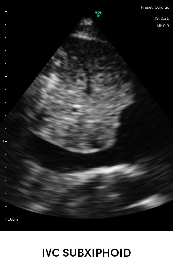 8 Best Portable Echo Ultrasound Machines for Cardiac Care