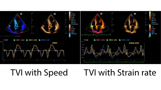 8 Best Portable Echo Ultrasound Machines for Cardiac Care